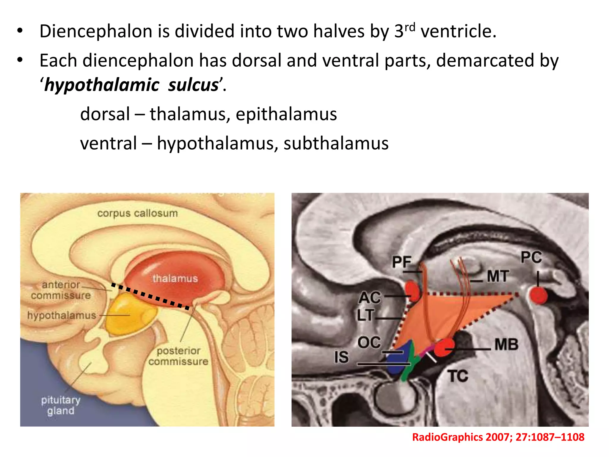 Sectional anatomy of brain part 2 | PPTX