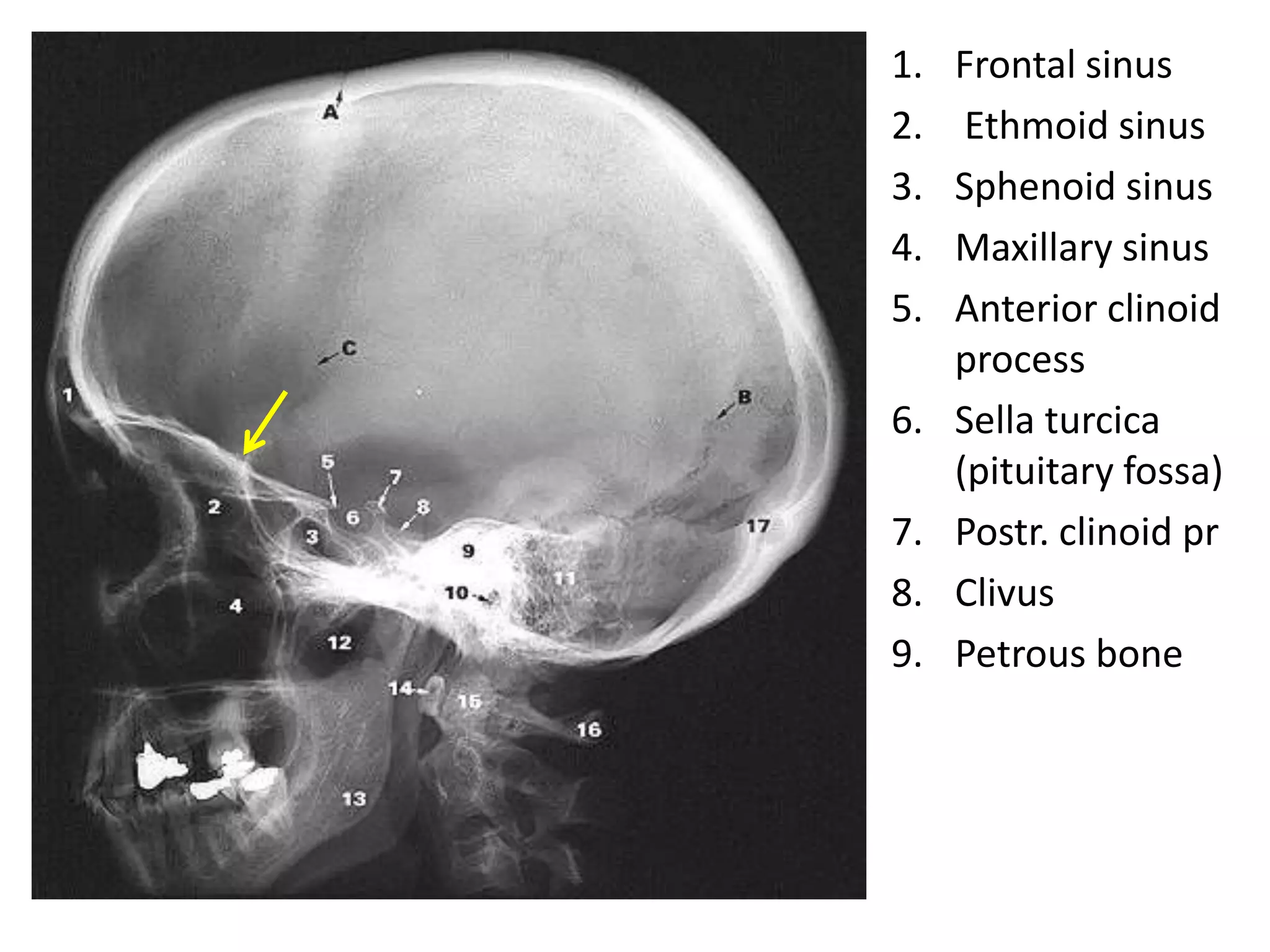 Sectional anatomy of brain part 2 | PPTX