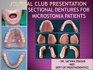 Sectional dentures for microstomia patients.pptx