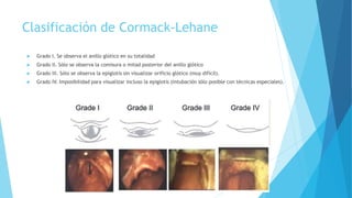 secuencia de intubacion rapida pediatria.pptx