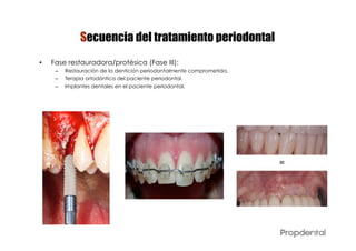 Secuencia de tratamientos periodontal | PDF