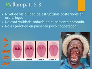 SECUENCIA rapida de intubacion en anestesia | PPT
