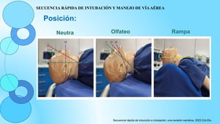 secuencia rapida de intubacion tema de medicina interna.pptx