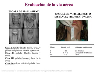 secuenciarapidamandar-200699910231146.pptx