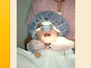 Sedation and general anesthesia in dentistry | PPTX