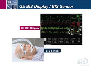 Sedation BIS monitorage | PPT | Healthcare Industry | Industries