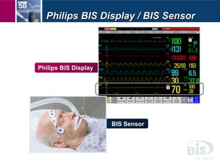 Sedation BIS monitorage | PPT