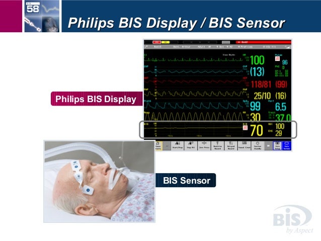 Sedation BIS monitorage