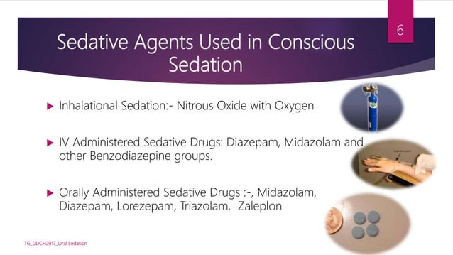 Conscious Sedation in Dental Practice | PPTX