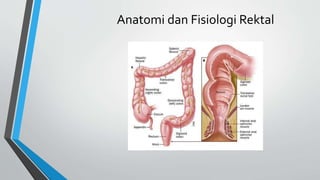 Sediaan rektal.pptx