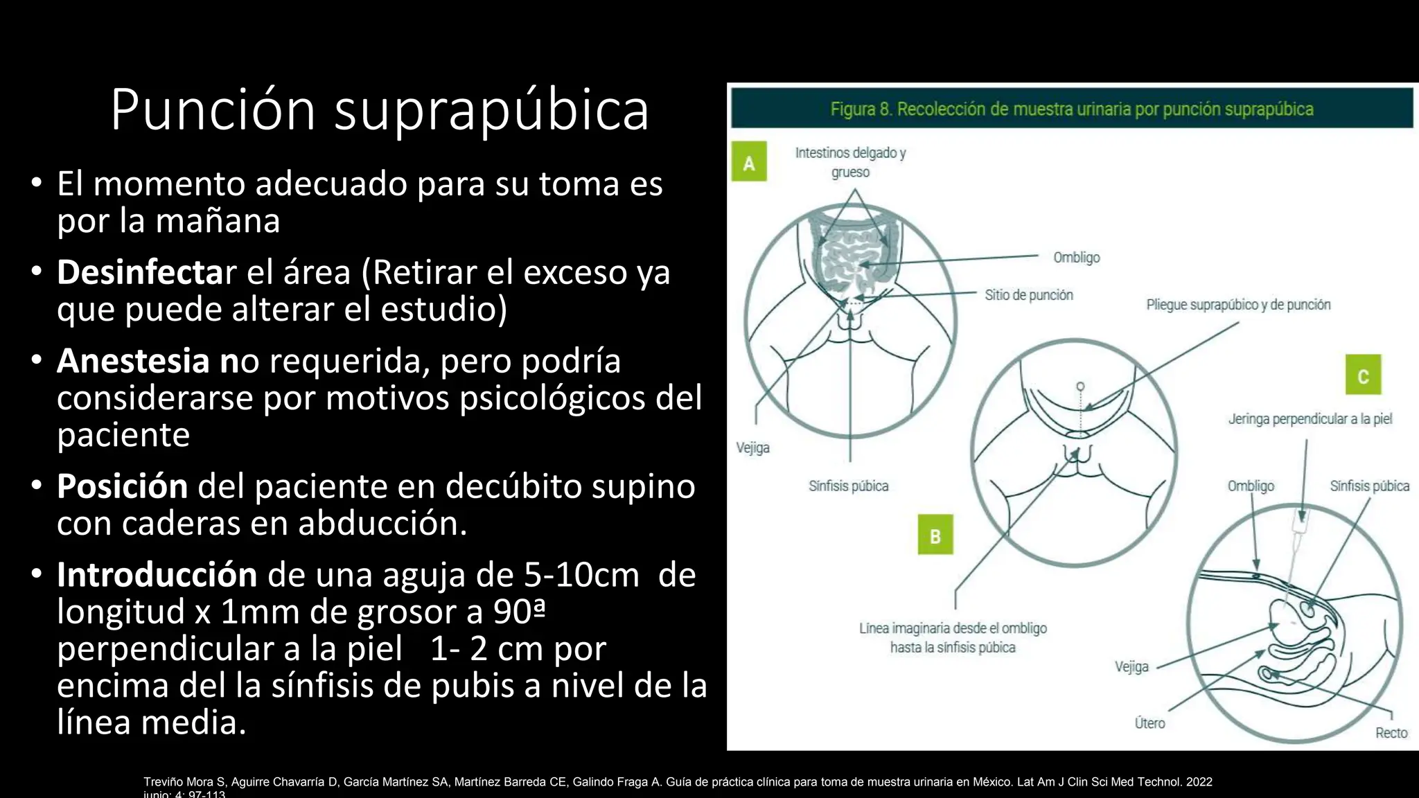 UROANALISIS Y SEDIMENTO URINARIO NEFROLOGIA | PPTX | Blood Disorders ...