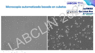 sedimento urinario caracteristicas y su formacion | PDF