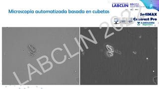 sedimento urinario caracteristicas y su formacion | PDF