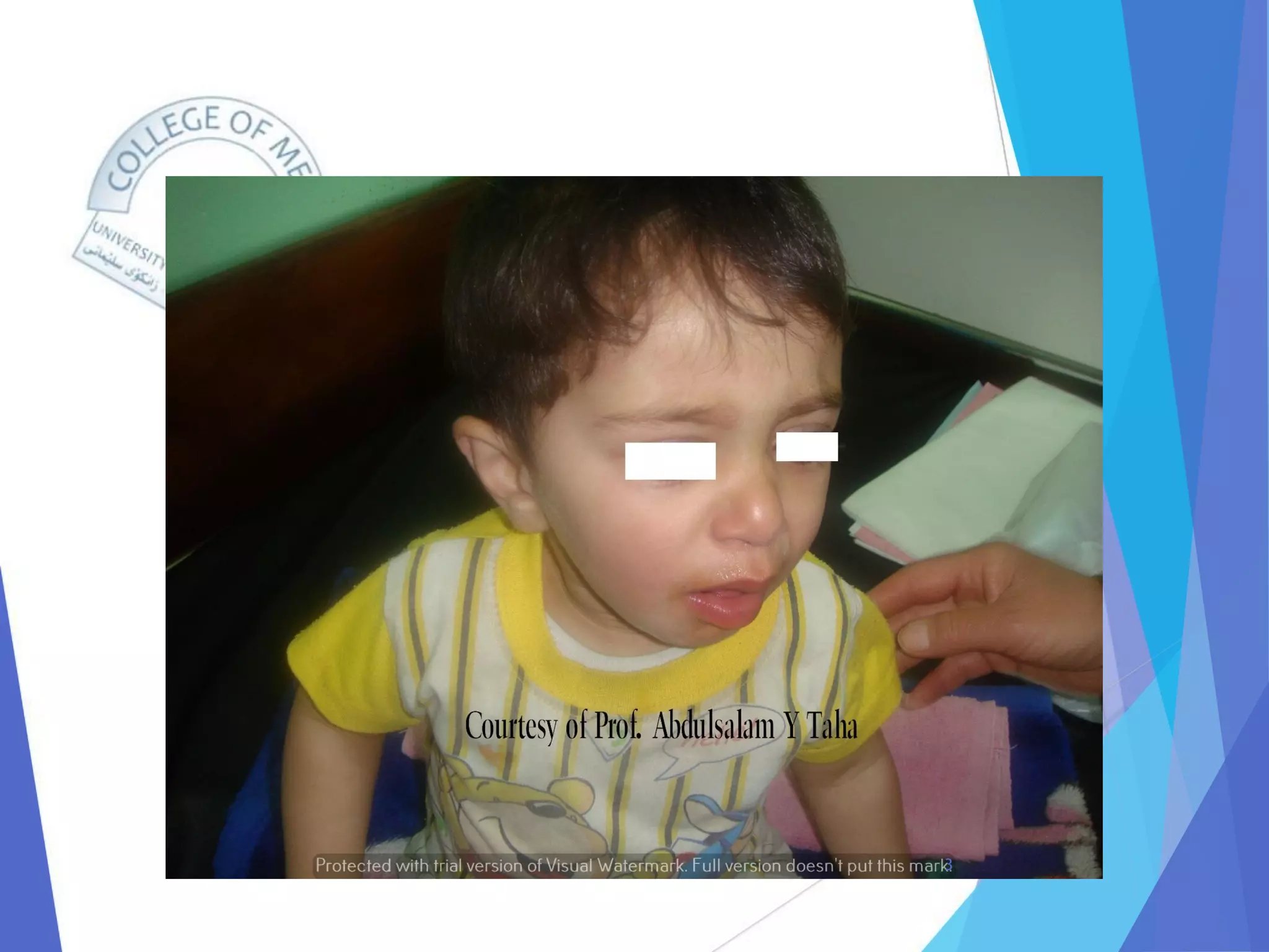 Seed in the Left Main Stem Bronchus.pdf