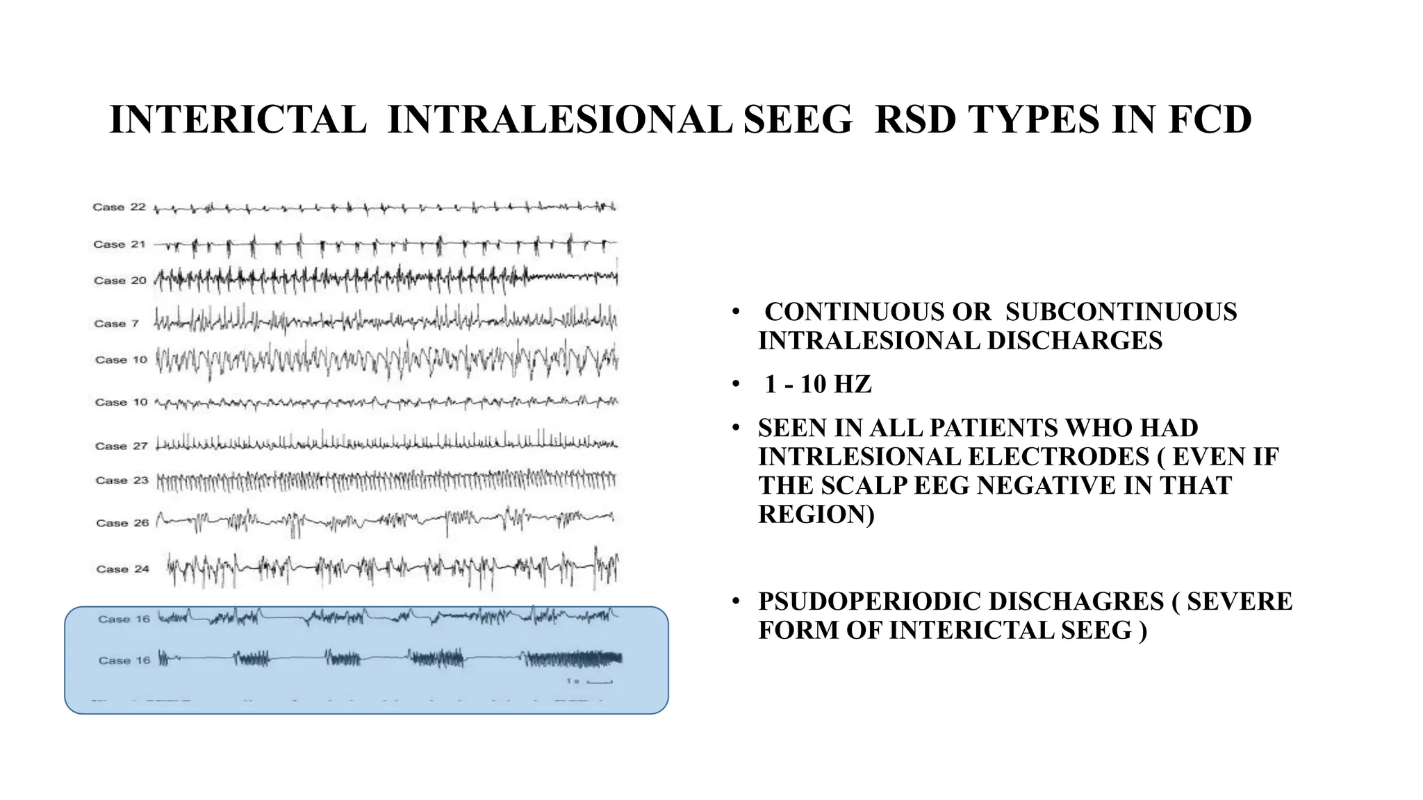 Stereo EEG or invasive EEG in Surgical epileptology.pptx