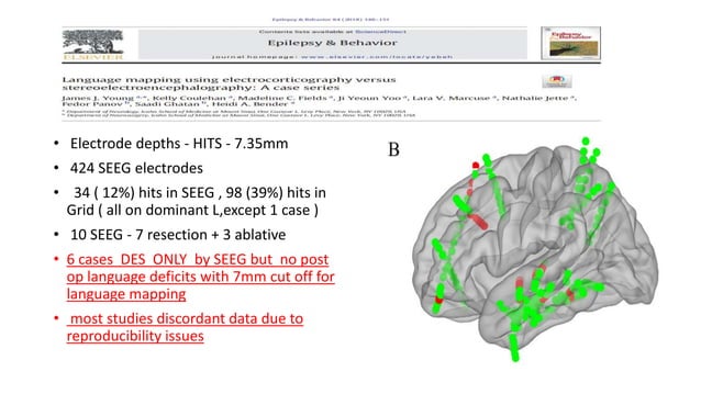 Stereo EEG or invasive EEG in Surgical epileptology.pptx