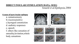 Stereo EEG or invasive EEG in Surgical epileptology.pptx