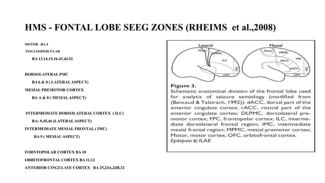Stereo EEG or invasive EEG in Surgical epileptology.pptx
