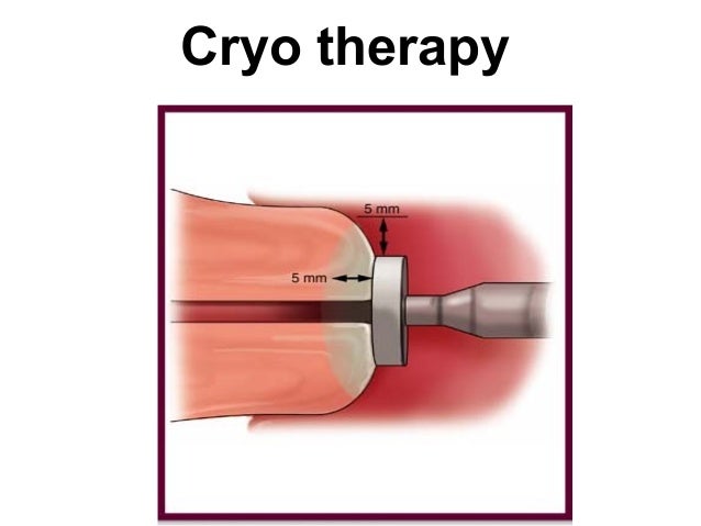 See & treat prog dr. sharda jain