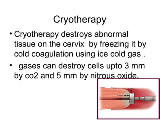 Cervical Cancer Prevention in Poor Resource areas : See & treatapproach ...