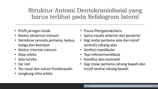 Sefalometri - Taufiq Julian Davit.pptx