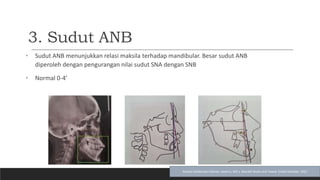 Sefalometri - Taufiq Julian Davit.pptx