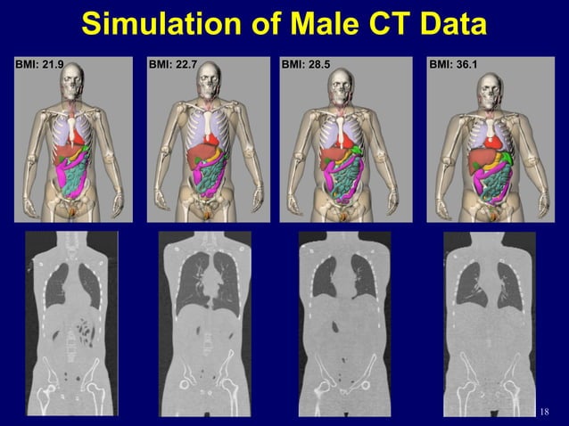 4d Computed Tomography Imaging In Radiotherapy Pptx Medical Tests Medical Health