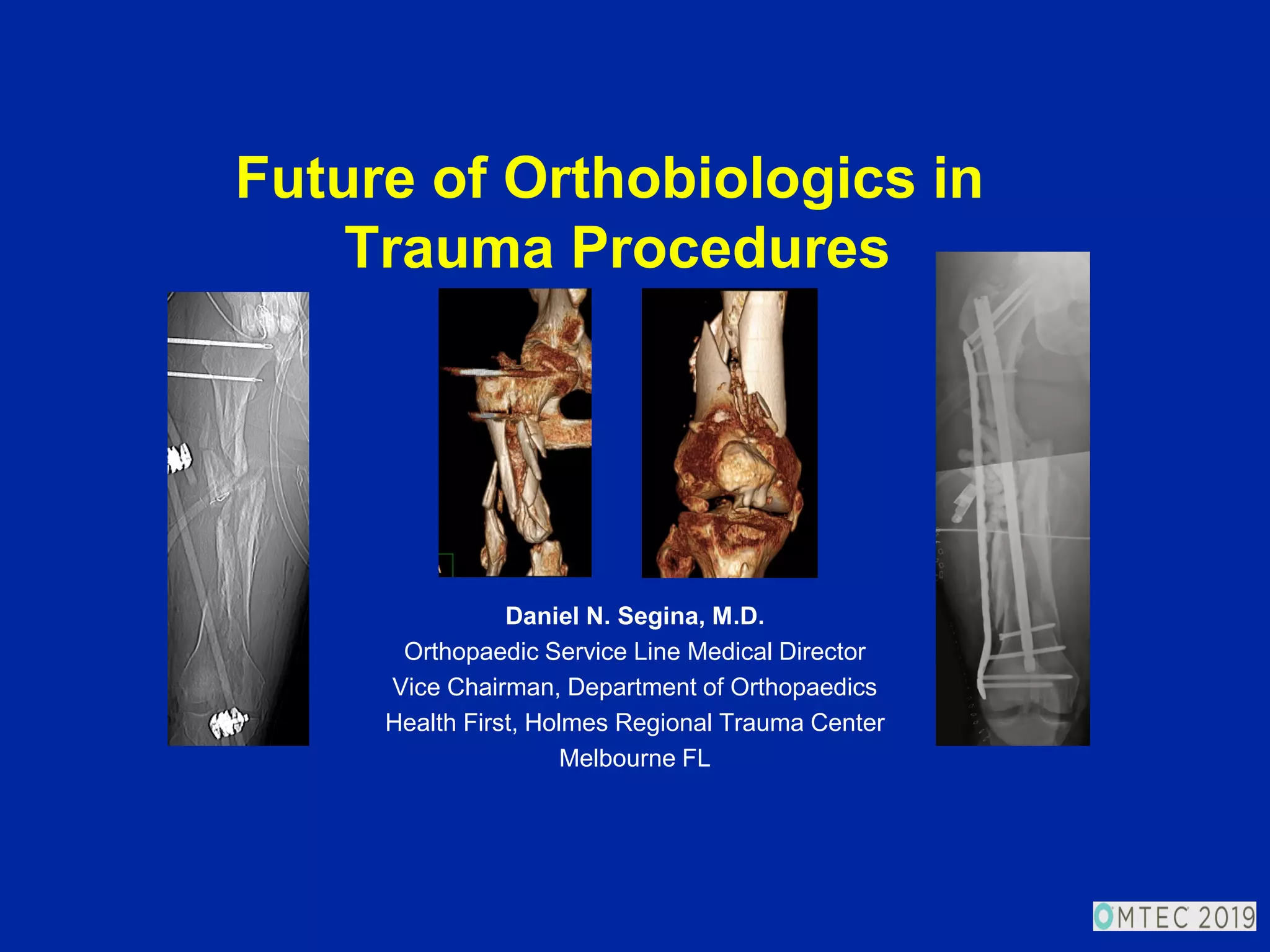 The Future of Orthobiologics in Trauma Procedures | PDF