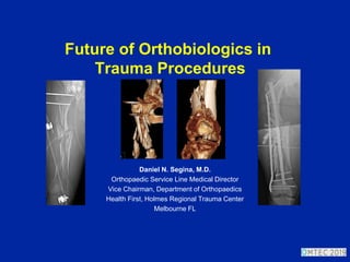 The Future of Orthobiologics in Trauma Procedures | PDF
