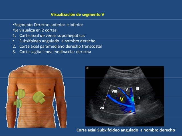 Segmentacion hepatica ecografia
