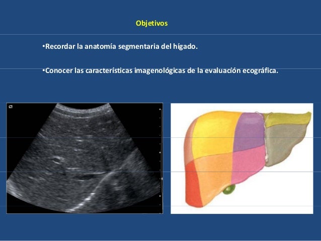 Segmentacion hepatica ecografia