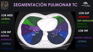 SEGMENTACION PULMONAR POR REVISION RADIOLOGIA | PPTX