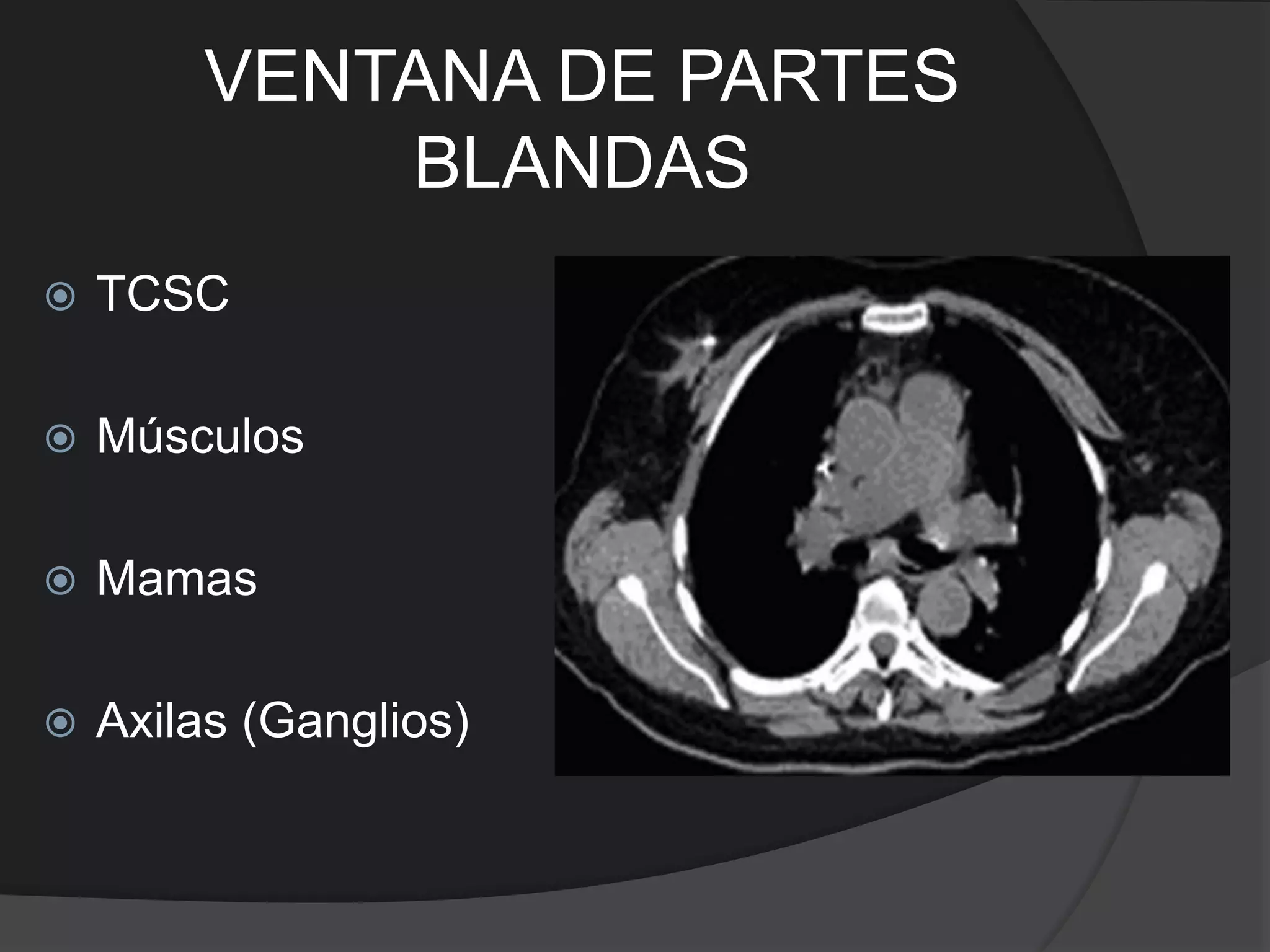 Segmentacion pulmonar tac | PPTX