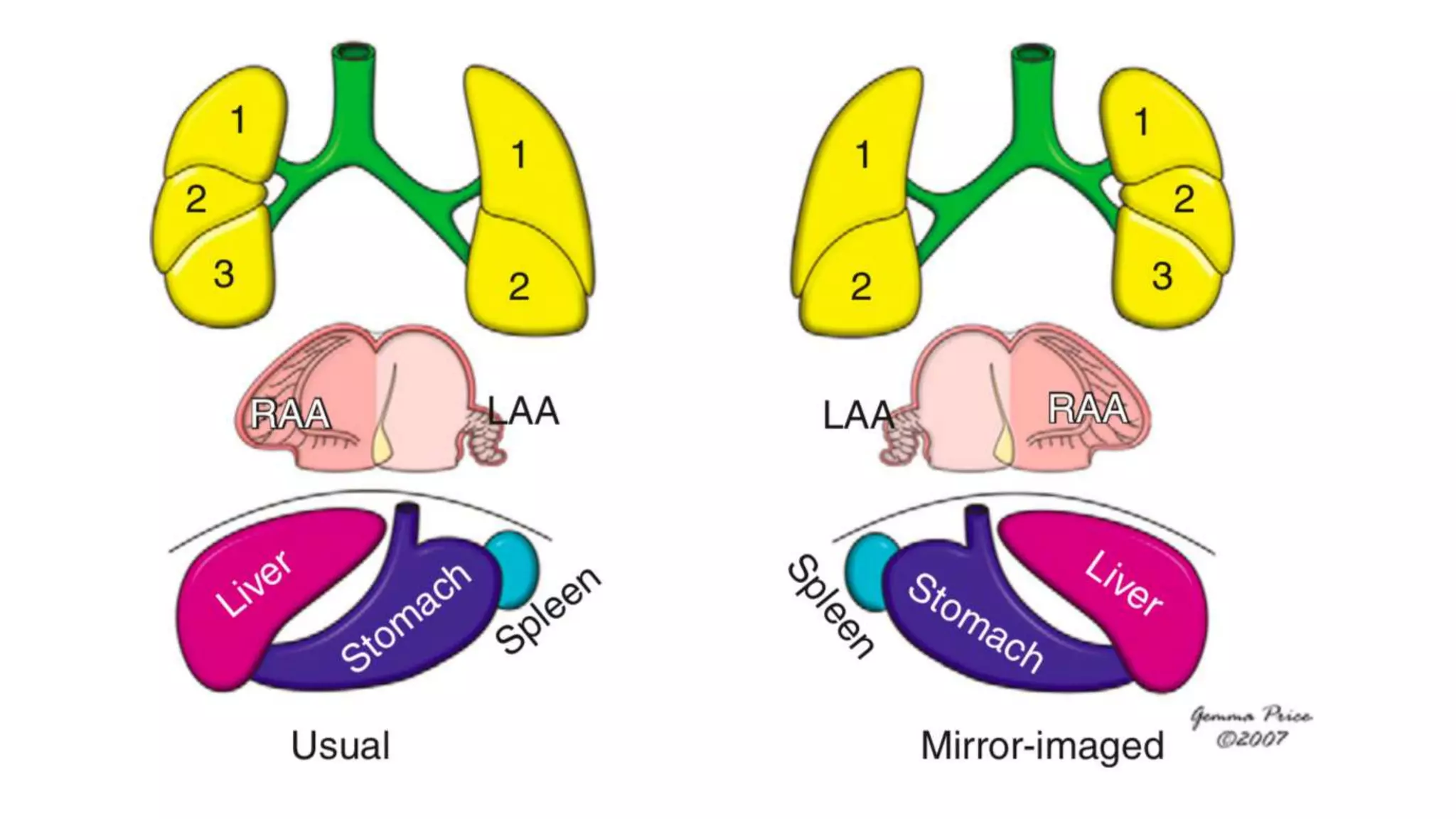Segmental analysis of heart anatomy | PPTX
