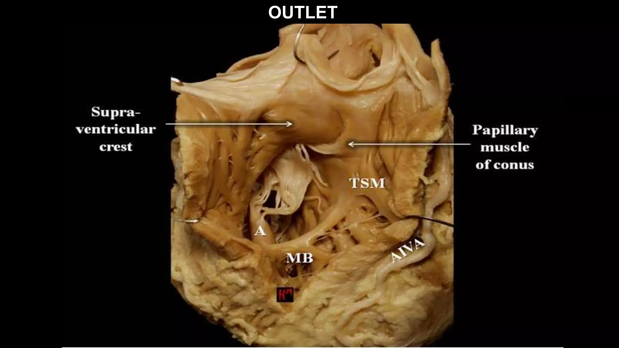 Segmental analysis of heart anatomy | PPTX