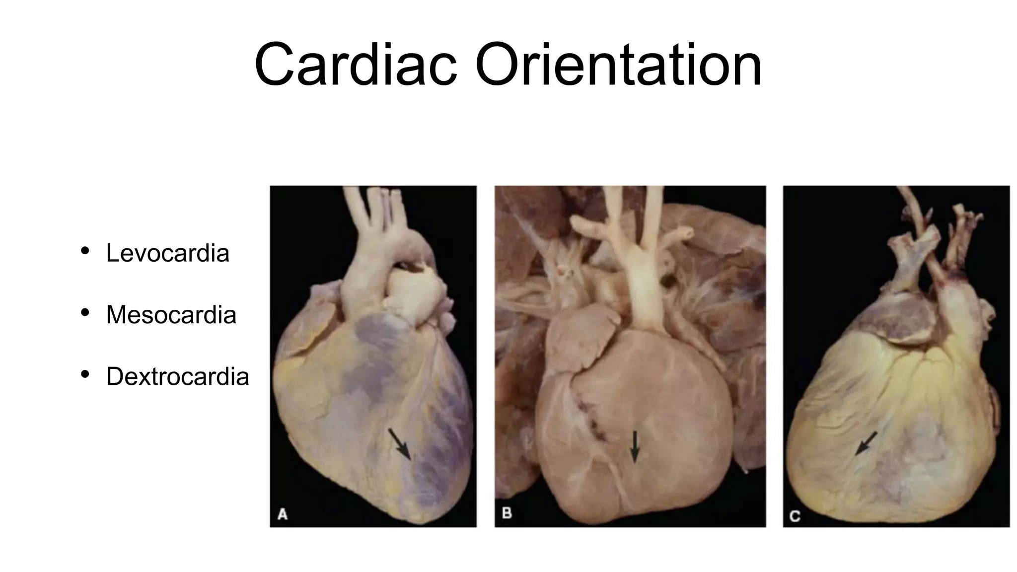 Segmental analysis of heart anatomy | PPTX