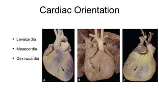 Segmental analysis of heart anatomy | PPT