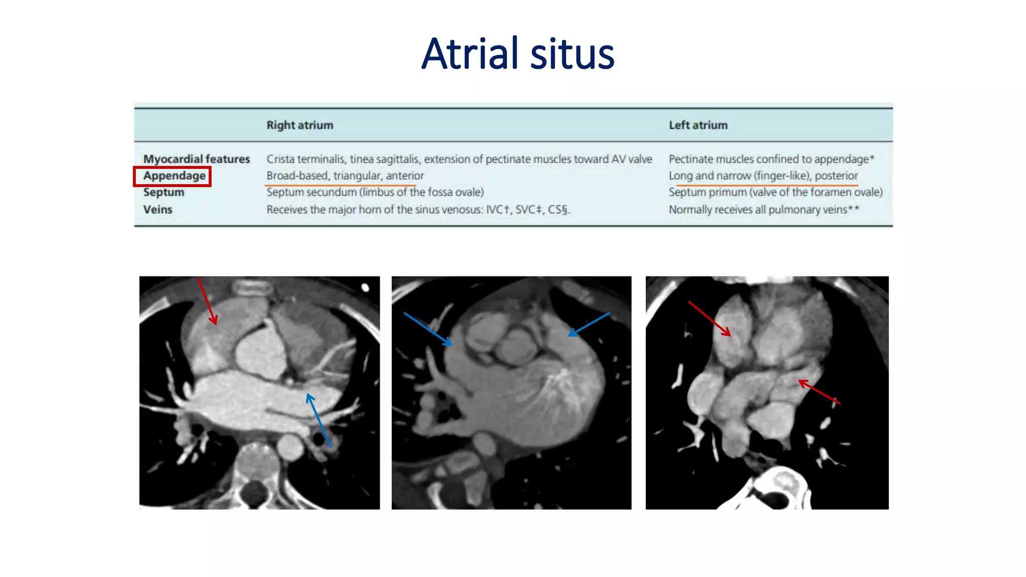 Segmental analysis in congenital heart diseases m.gibreel | PPTX