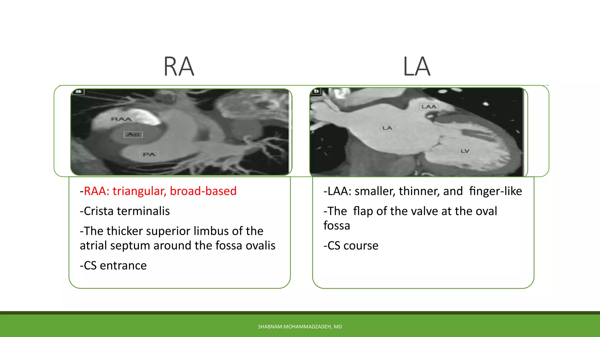 Segmental approach in congenital heart disease [autosaved].pptx 2.pptx ...