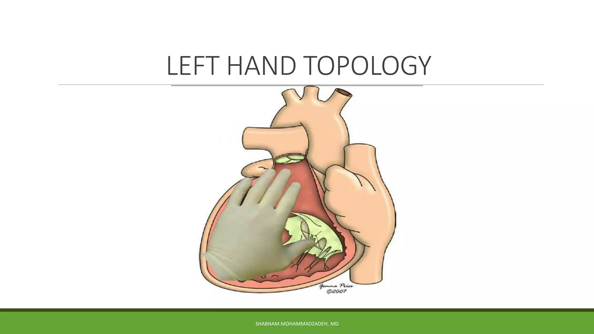 Segmental approach in congenital heart disease [autosaved].pptx 2.pptx ...