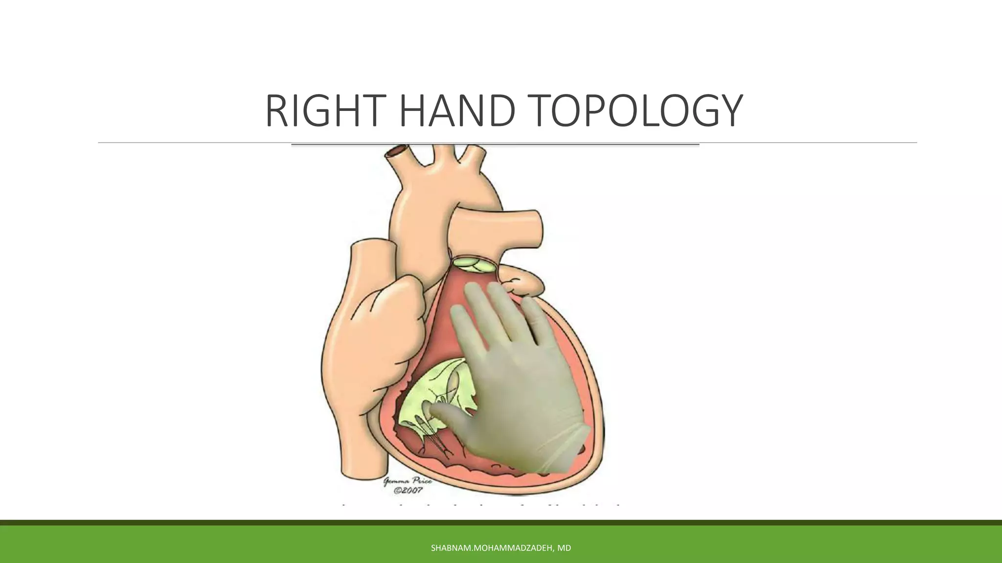 Segmental approach in congenital heart disease [autosaved].pptx 2.pptx ...