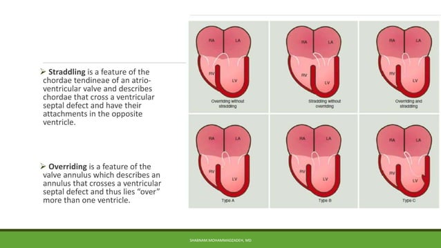 Segmental approach in congenital heart disease [autosaved].pptx 2.pptx ...