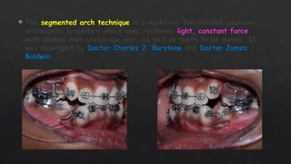 SEGMENTAL ARCH..... ..........pptx