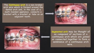 SEGMENTAL ARCH..... ..........pptx