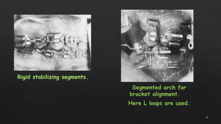 SEGMENTAL ARCH..... ..........pptx
