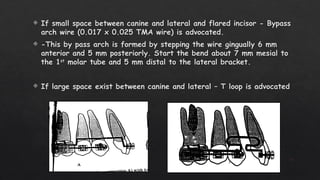 SEGMENTAL ARCH..... ..........pptx