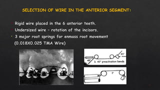 SEGMENTAL ARCH..... ..........pptx