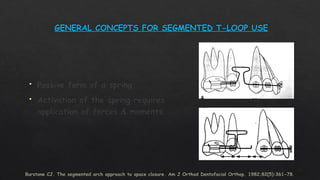 SEGMENTAL ARCH..... ..........pptx