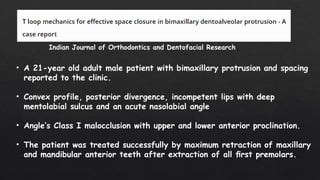 SEGMENTAL ARCH..... ..........pptx