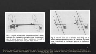 SEGMENTAL ARCH..... ..........pptx